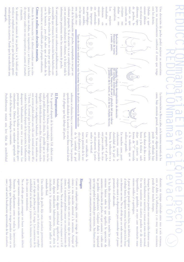 Reduccion-Mamaria-Elevacion-Pecho – AECEP